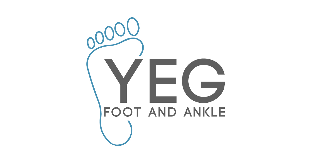 Ankle Ligament Surgery In Edmonton | YEG Foot and Ankle Inc